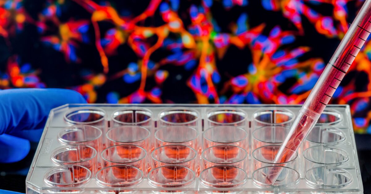 BioMed X and AbbVie Extend Research Collaboration in the US – BioMed X ...