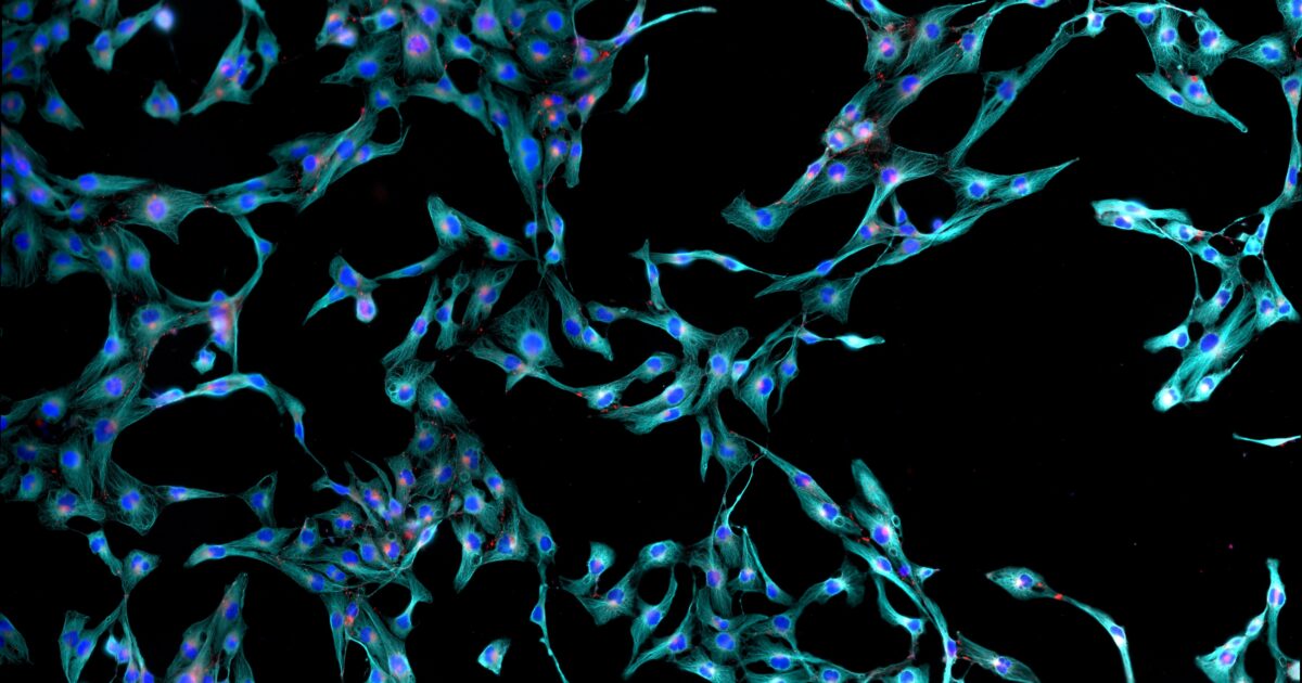 BioMed X Launches XSeed Labs in the US with Boehringer Ingelheim – a ...